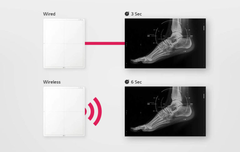 Why Podiatry Digital X-ray makes sense for your practice